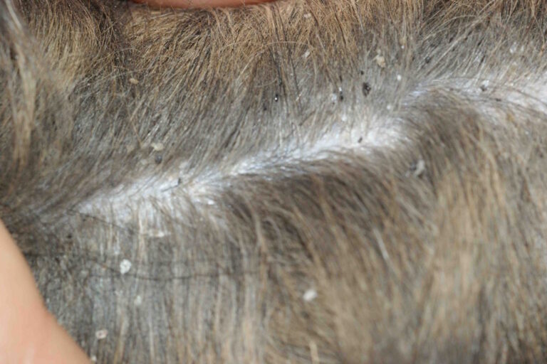 Cheyletiellosis in Pets: Symptoms, Diagnosis, and Treatments